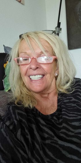 Snap-on Teeth Veneers – zynutra